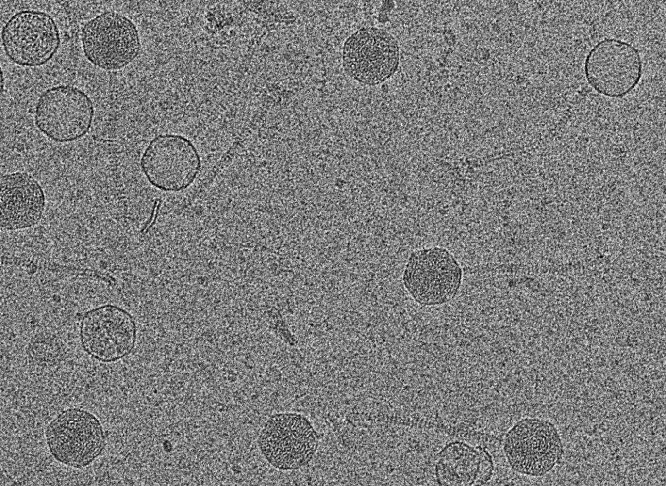 Bacteriophage | TEM image analysis | QuTEM